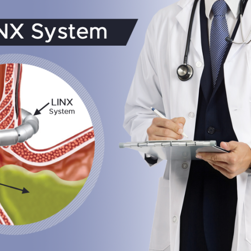 Calories for Thousands of Foods: Your Calorie Chart Database - Marie On ...